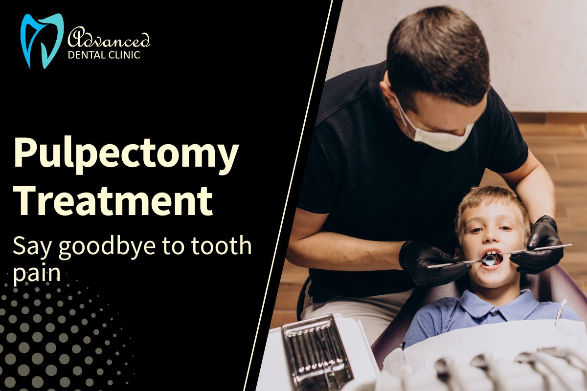 Pulpectomy Treatment Delhi: Understand about Kids Pulpectomy Treatment