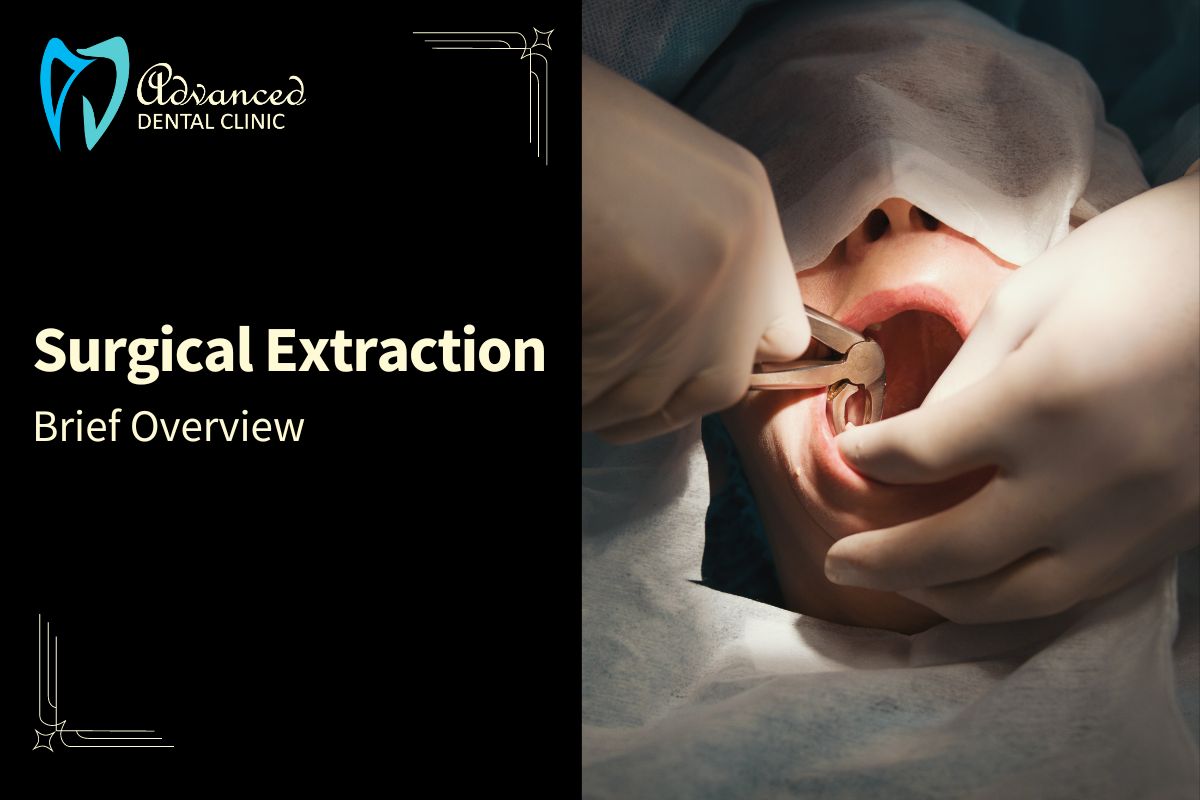 Surgical Tooth Extraction in Delhi - Advanced Dental Clinic East Delhi