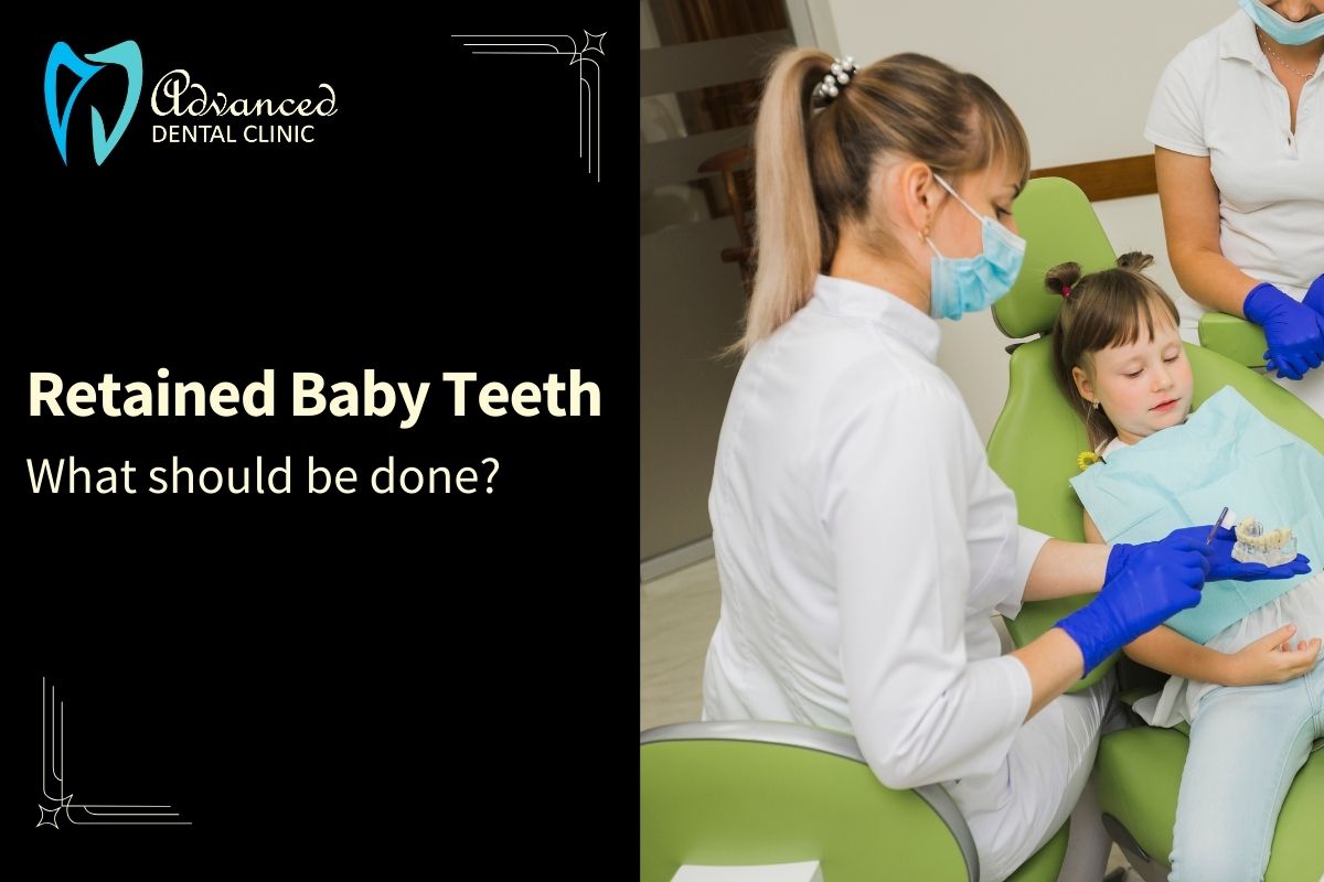 What to do when a baby tooth won’t fall out - Advanced Dental Clinic ...
